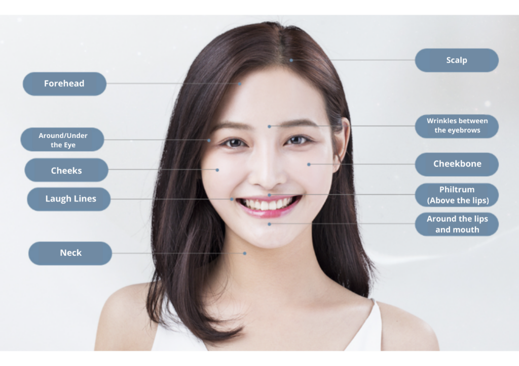 Stem Cell Therapy Skin Injections - Amoa 640